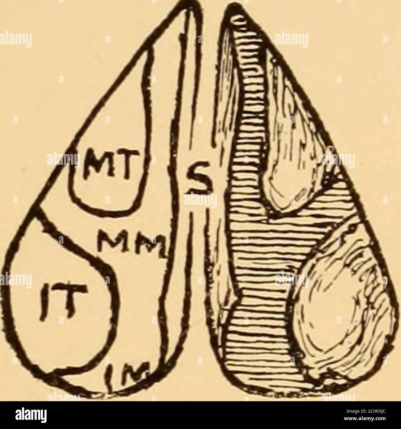 Faucial Pillars Diagram