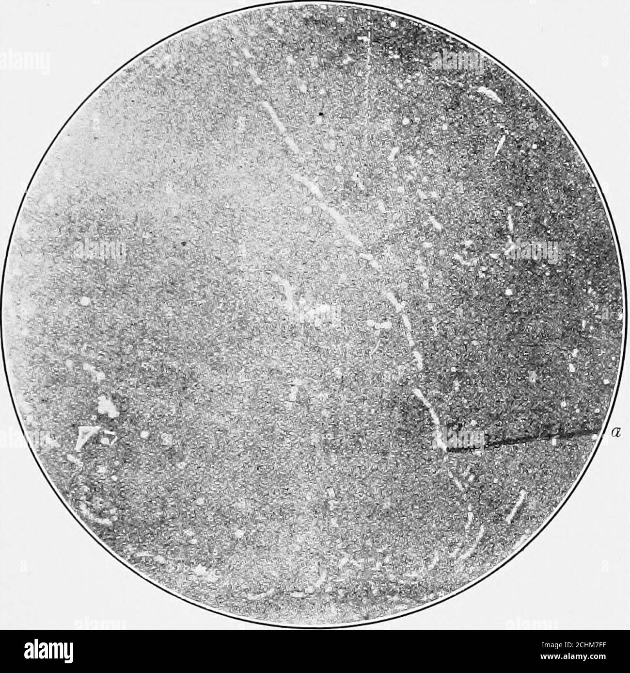 Infected with parasite Black and White Stock Photos & Images - Alamy