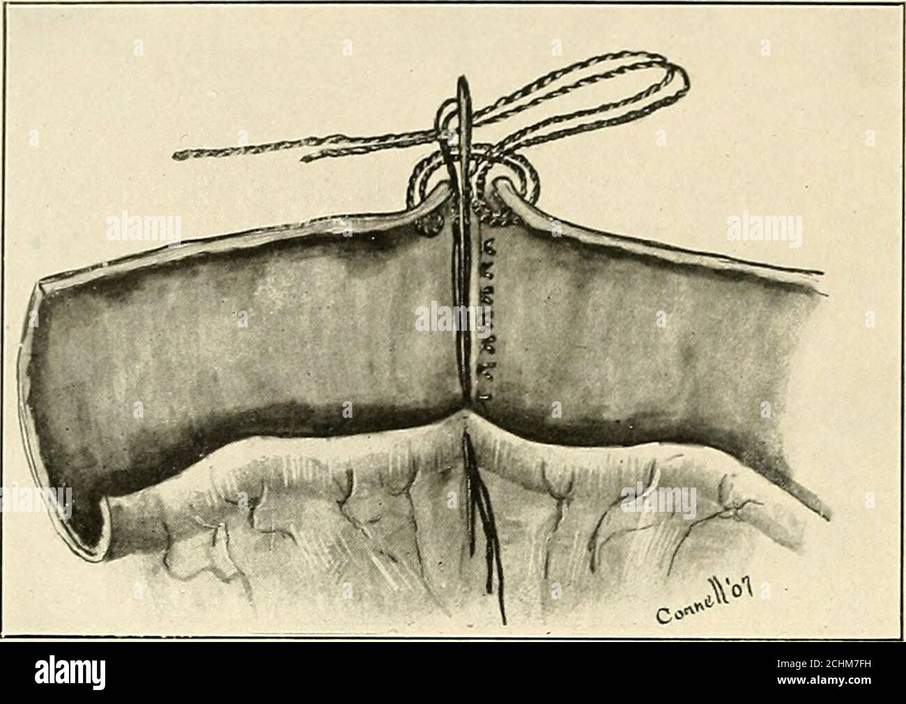 . American practice of surgery ; a complete system of the science and ...