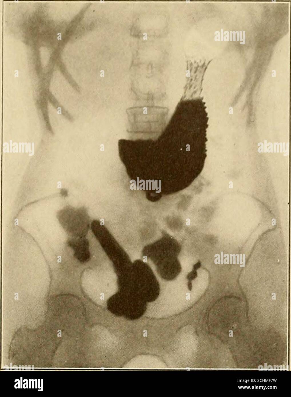 Iodides hi-res stock photography and images - Alamy