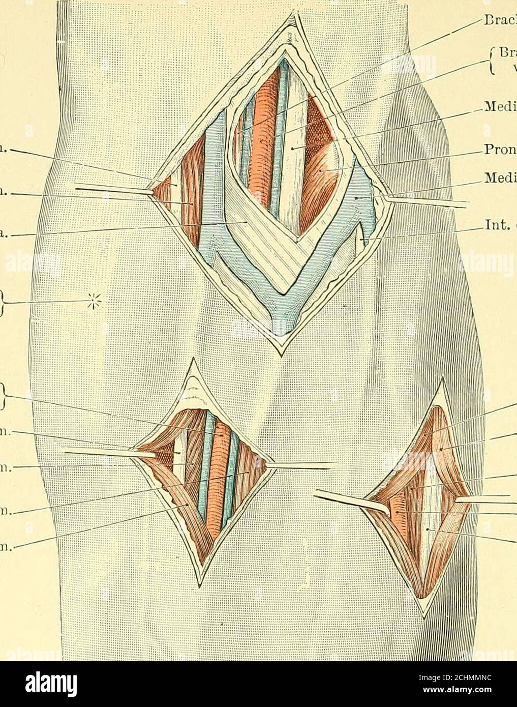 . Text-book of operative surgery . ular septum. The incision (Fig. 44 ...
