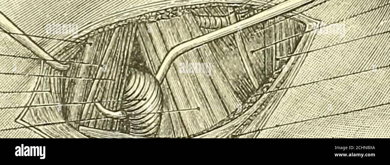 Greater cornu hi-res stock photography and images - Alamy