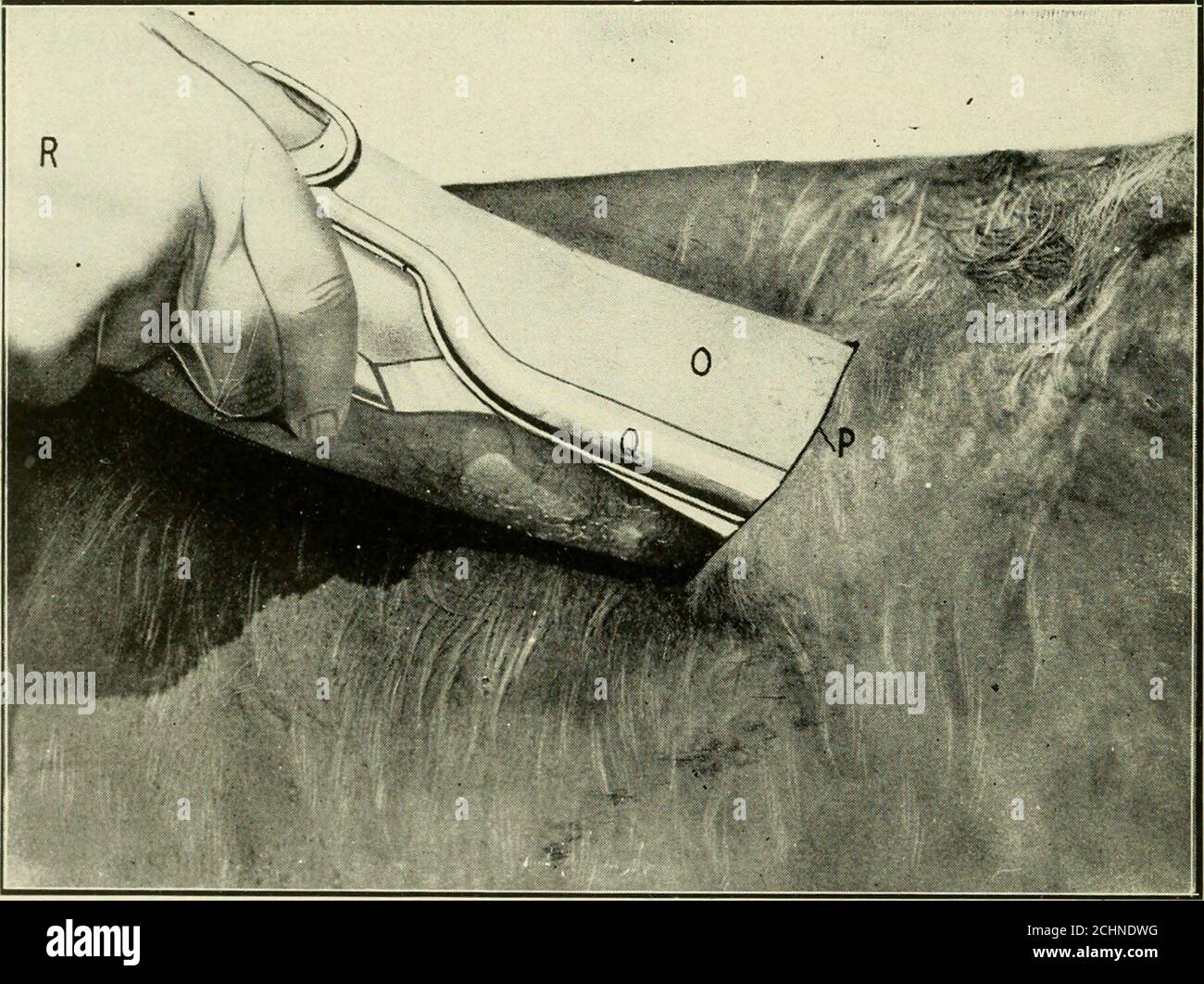 Abdominal thrust hi-res stock photography and images - Alamy