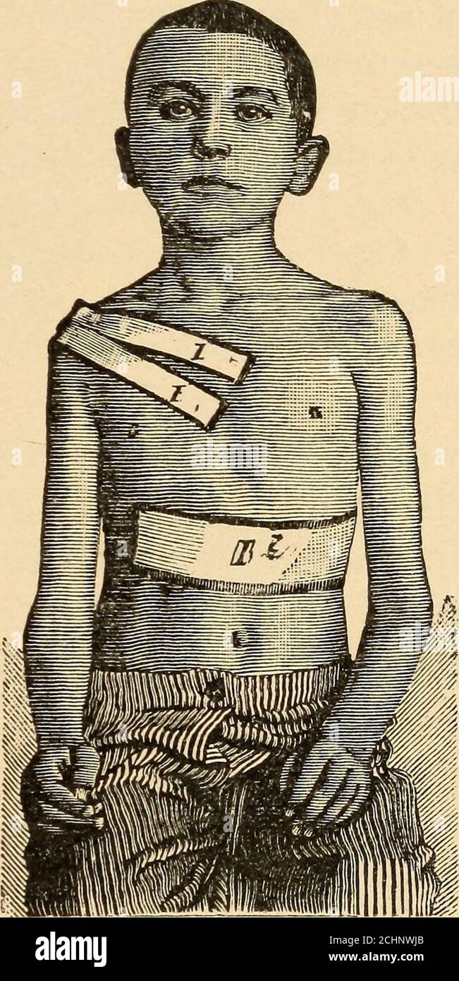 . Atlas and epitome of traumatic . Fig. 41. Fig. 42. Figs. 41 and 42 ...