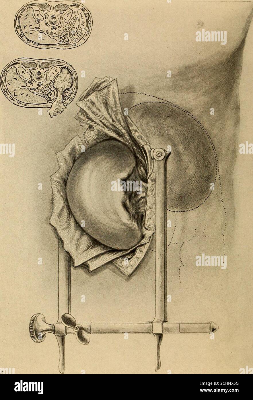 Hypochondrium hi-res stock photography and images - Alamy