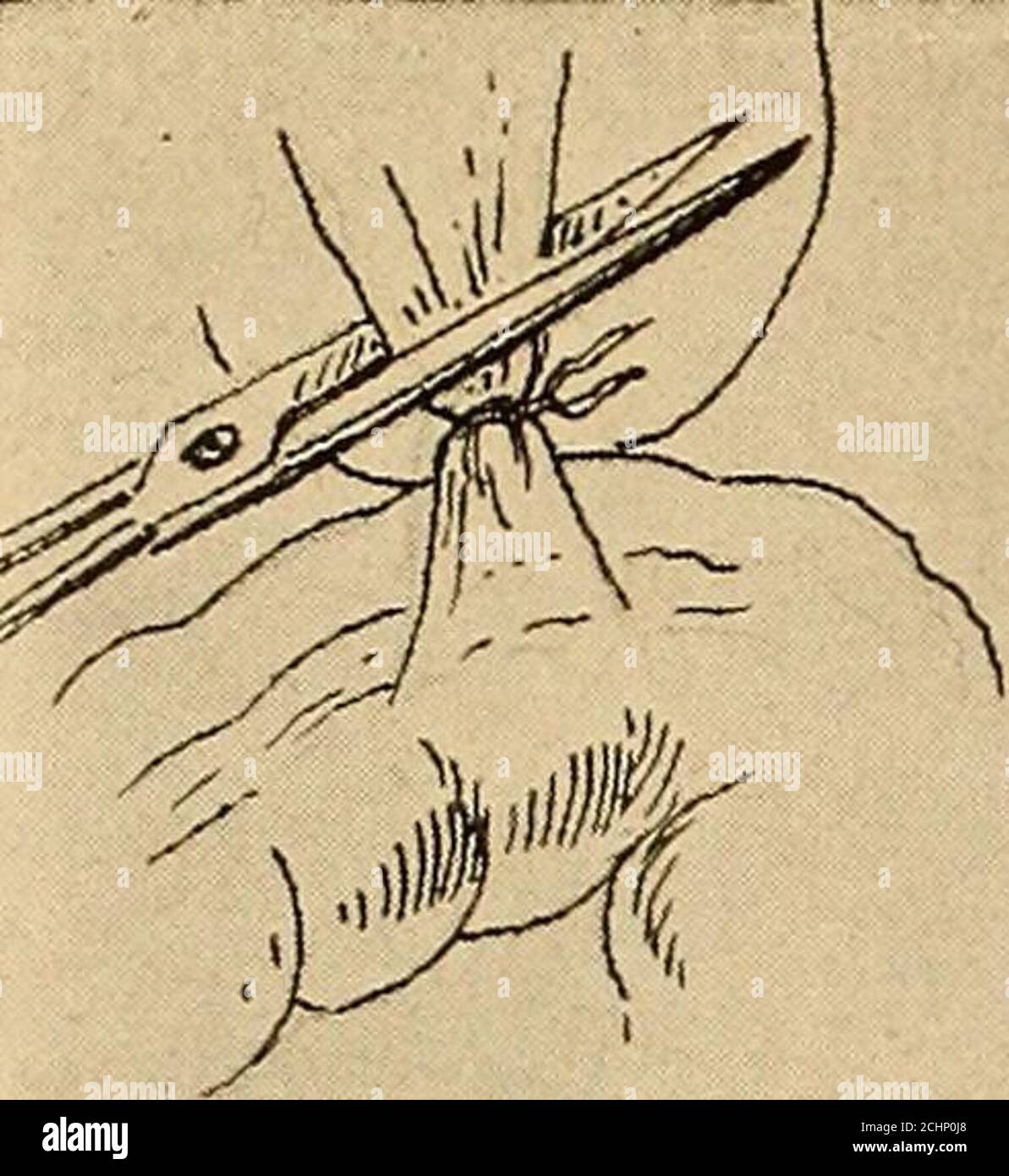 . The spleen and anæmia; experimental and clinical studies . The ...