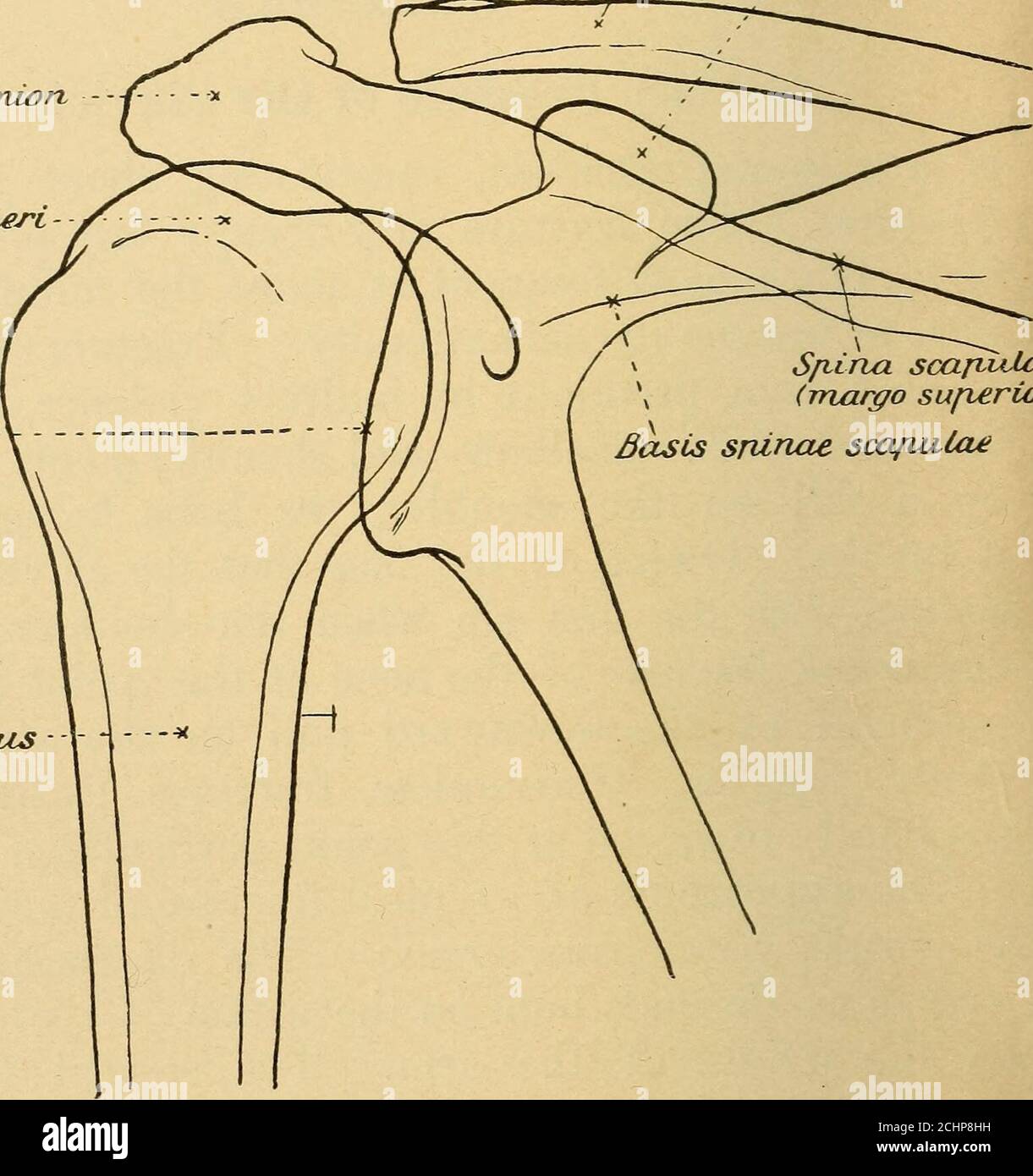 . Atlas and epitome of traumatic . rm. The sternal fragment isacted on ...