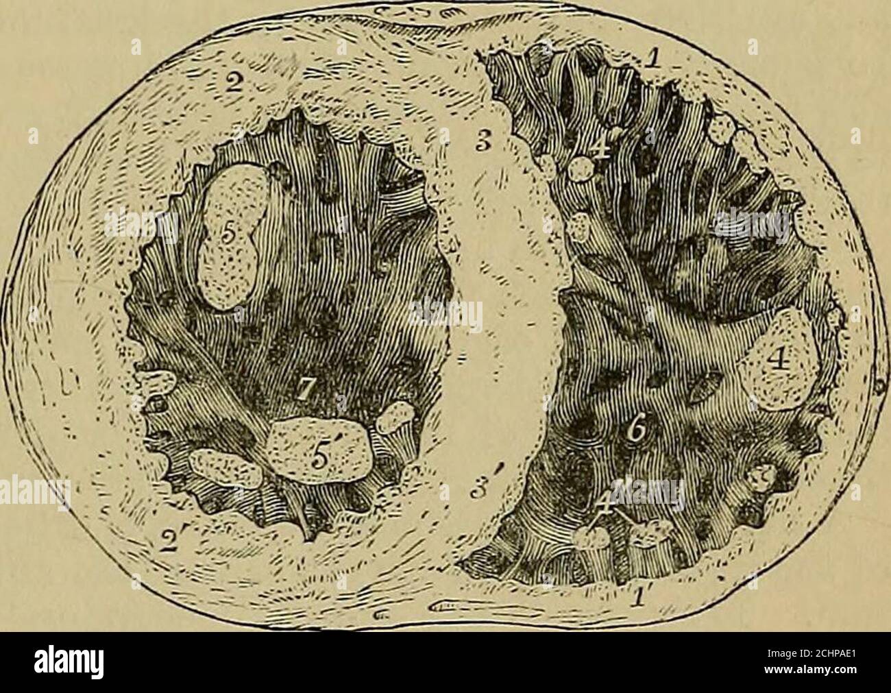 Tendinous cords hi-res stock photography and images - Alamy
