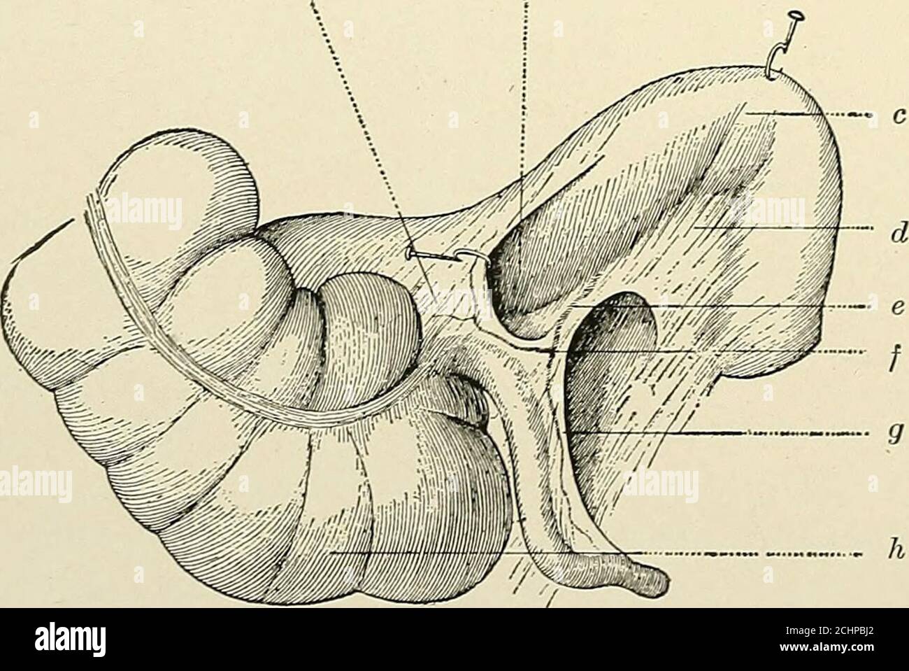 . American practice of surgery ; a complete system of the science and ...