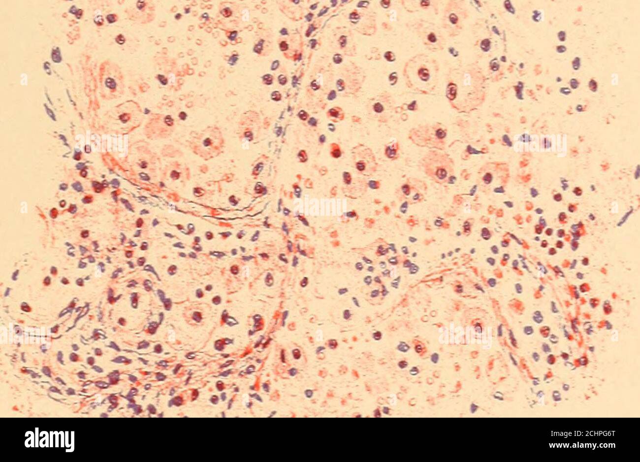 . The spleen and anæmia; experimental and clinical studies . Histology ...