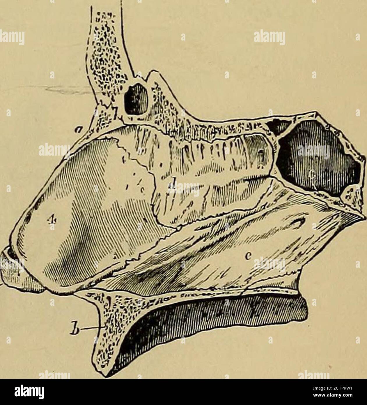 Vomer Perpendicular Plate