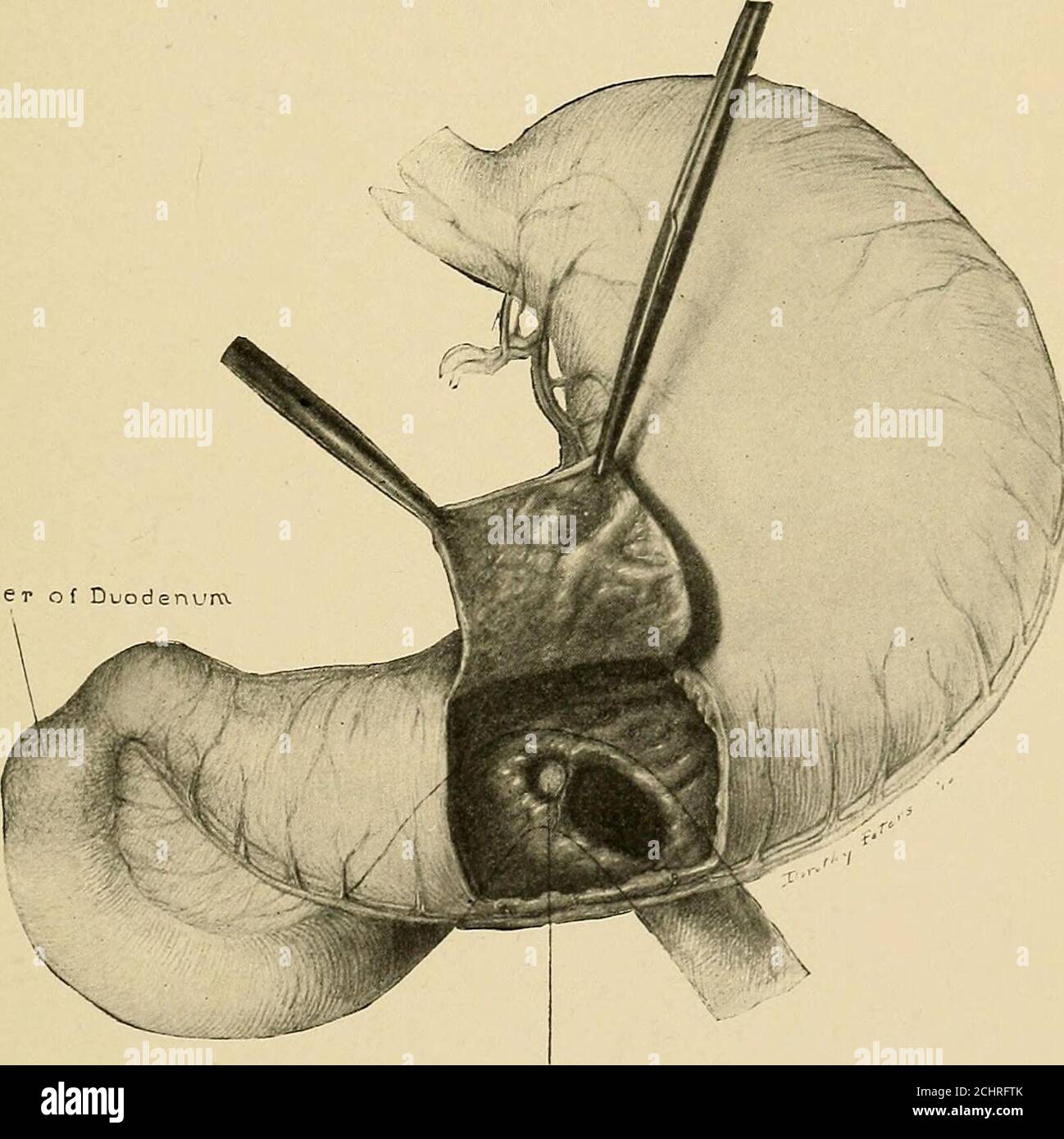. Diseases of the stomach : including dietetic and medicinal treatment ...