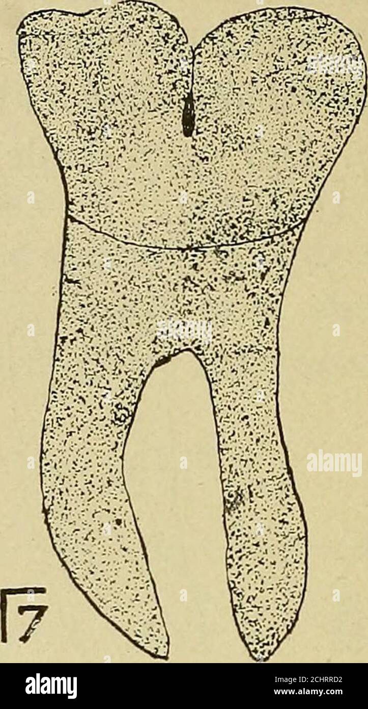 . Operative and dental anatomy technics; a class-room and laboratory ...
