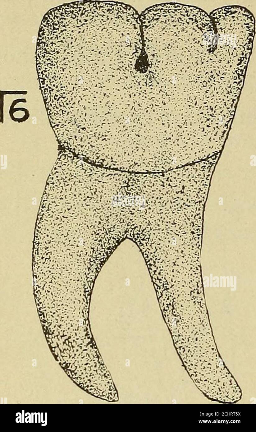 . Operative and dental anatomy technics; a class-room and laboratory ...