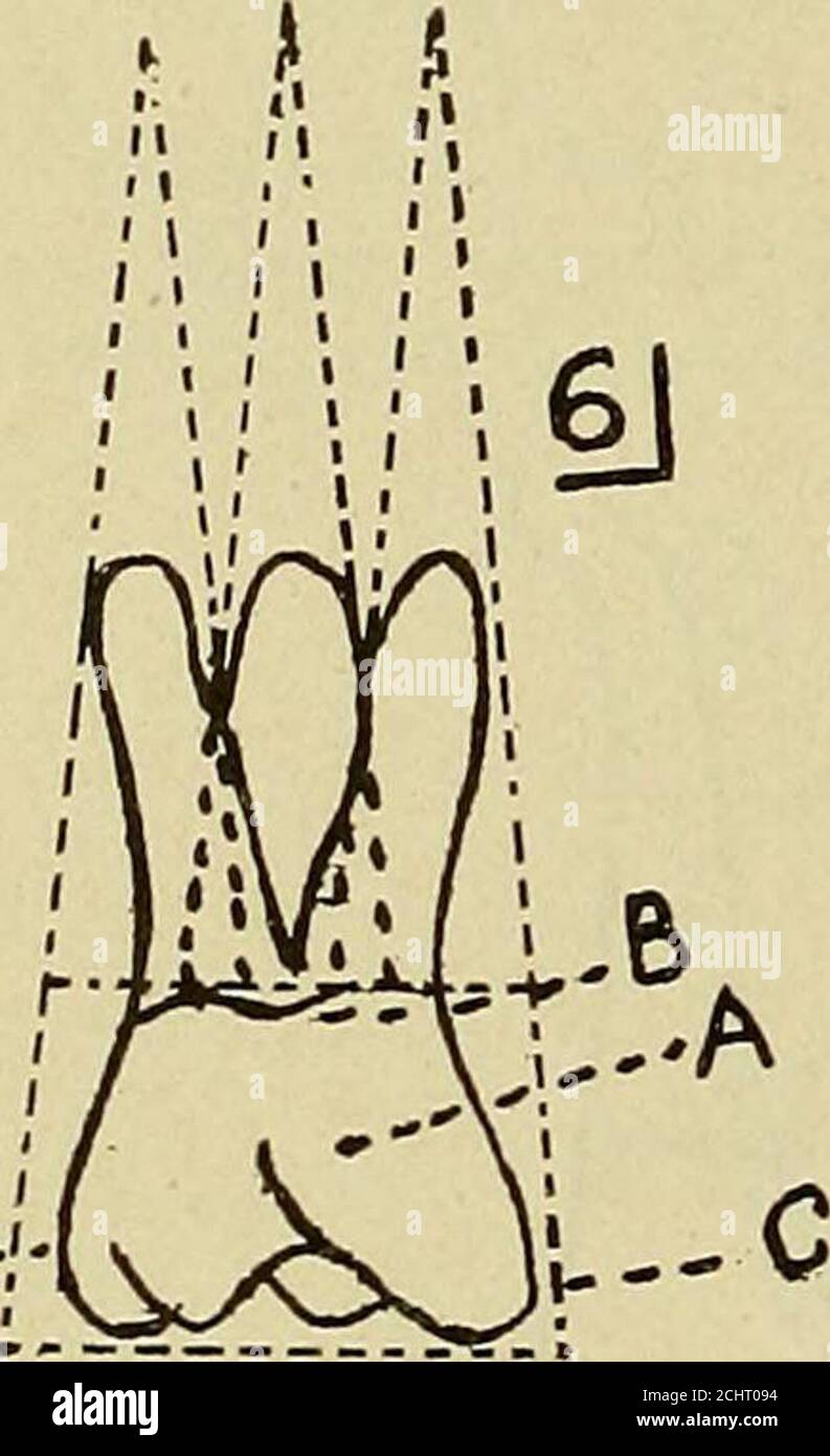 . Operative and dental anatomy technics; a class-room and laboratory ...