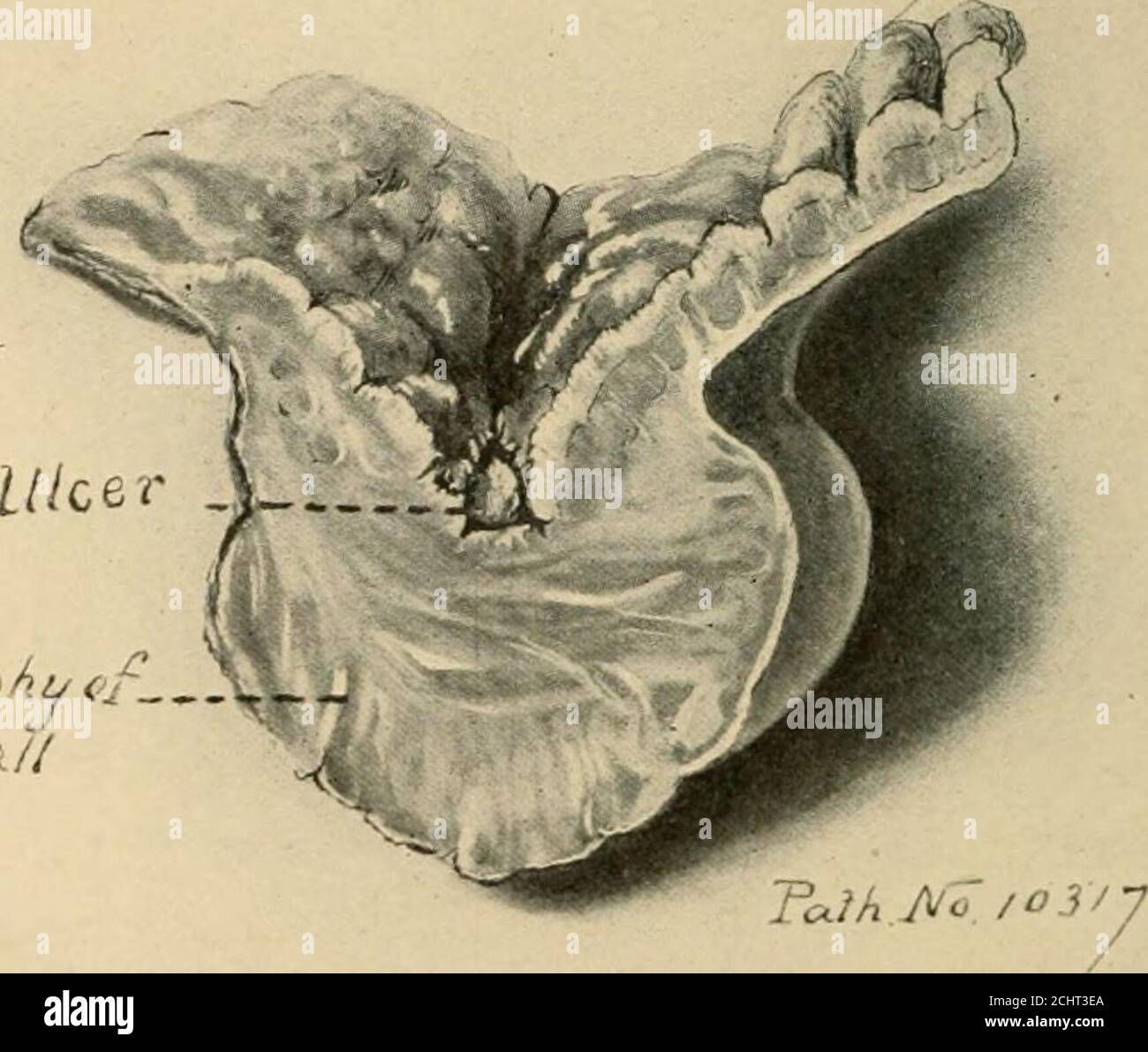Dense connective tissue hi-res stock photography and images - Alamy