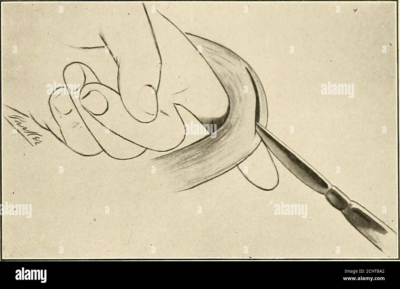Blunt Dissection High Resolution Stock Photography and Images - Alamy