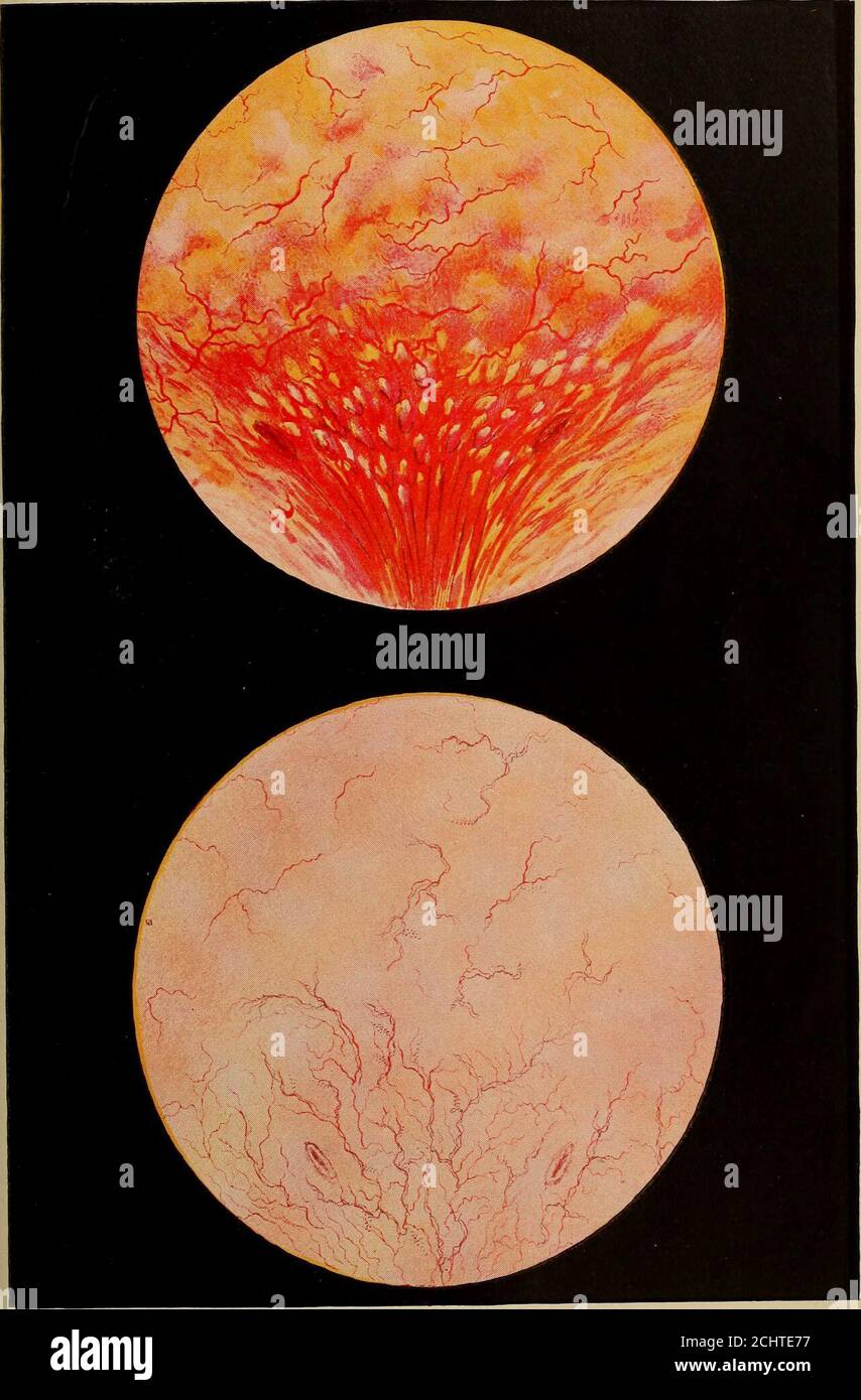 . The diagnosis of diseases of women . Fig. 2. Ulcerated Pateties in ...