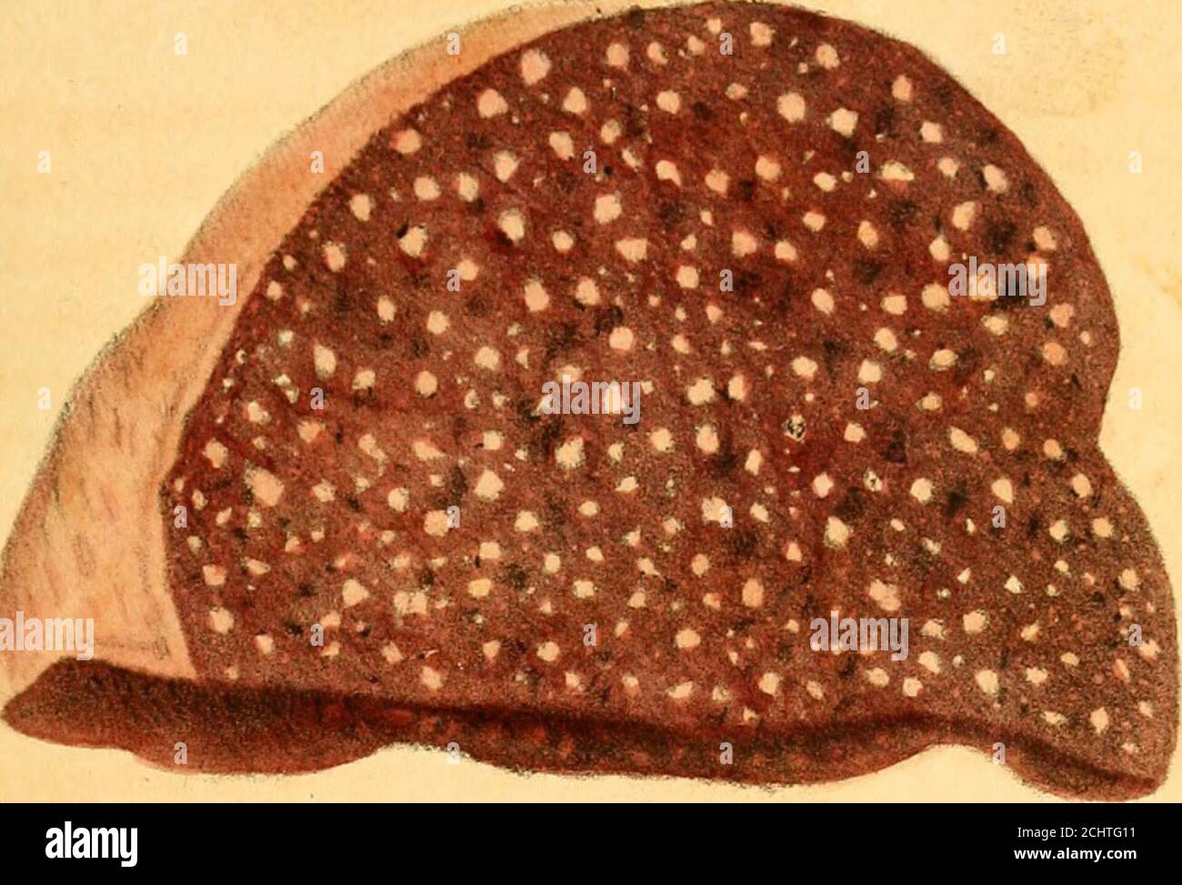 Cicatrized hi-res stock photography and images - Alamy