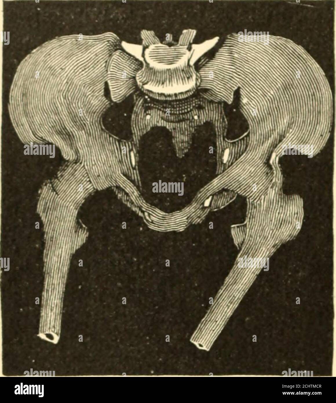 Gangrene head hi-res stock photography and images - Alamy