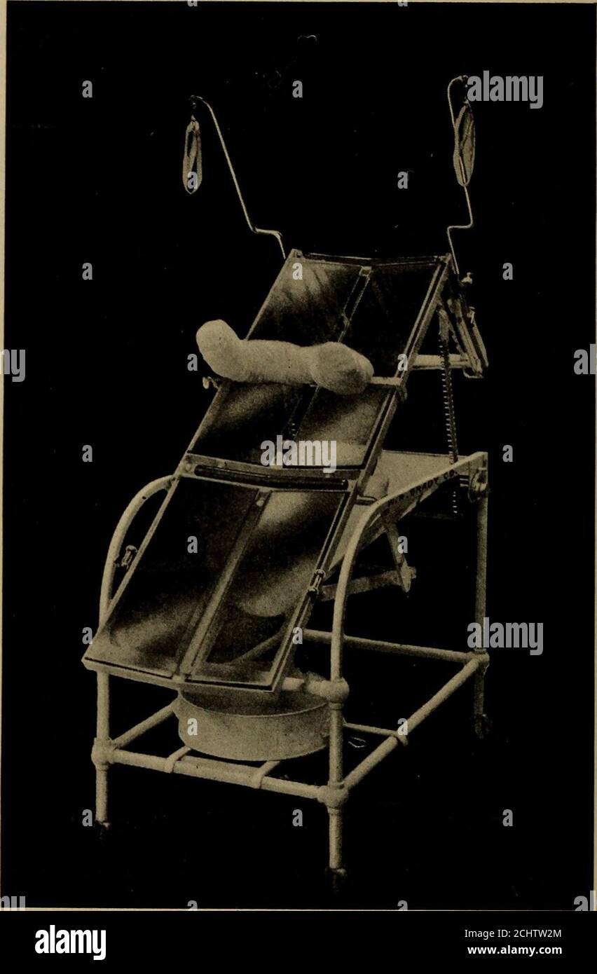 Bladder mucosa hi-res stock photography and images - Alamy