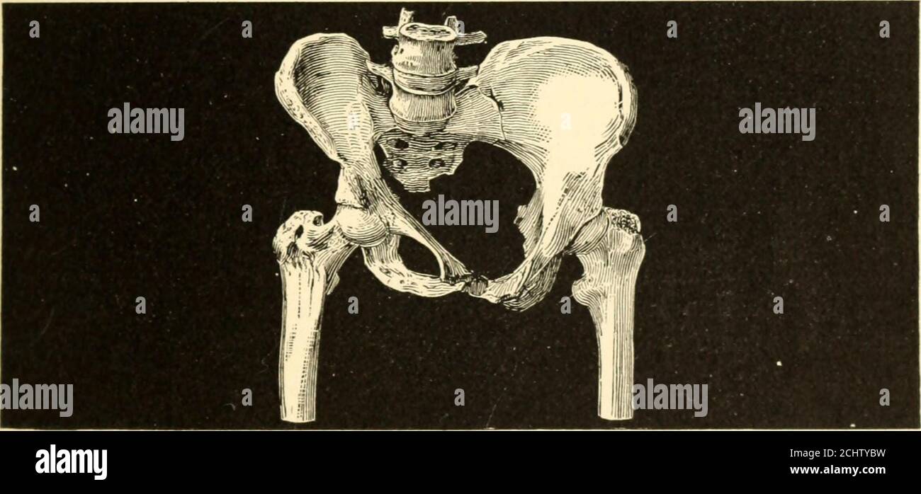 Sacro iliac joint hi-res stock photography and images - Alamy