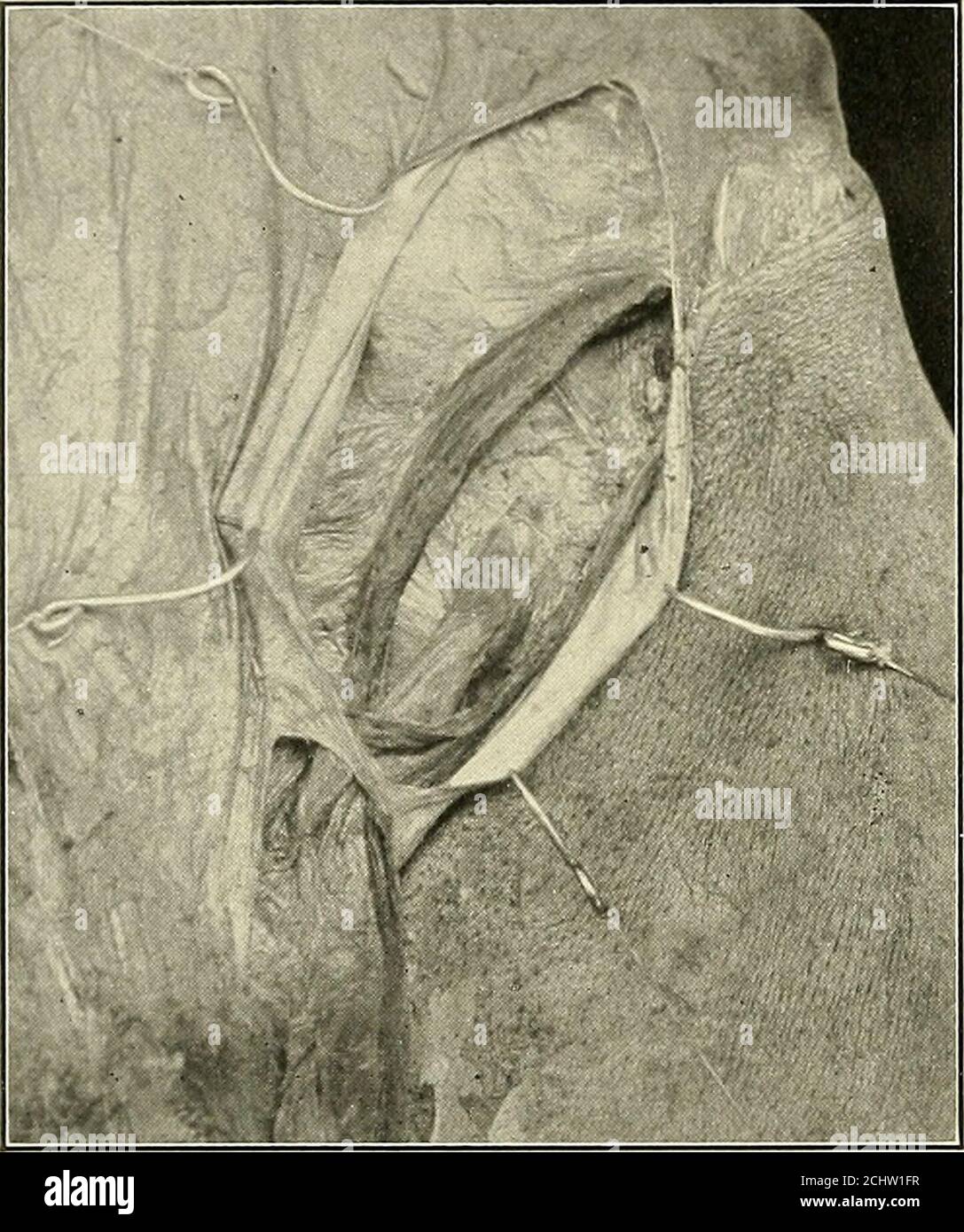 Epigastric region hi-res stock photography and images - Alamy
