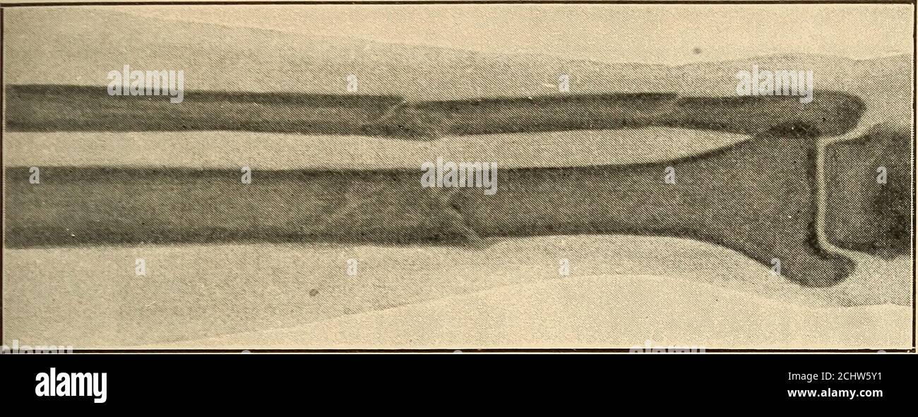 . Atlas and epitome of traumatic . rounds the endsof the fragments like ...