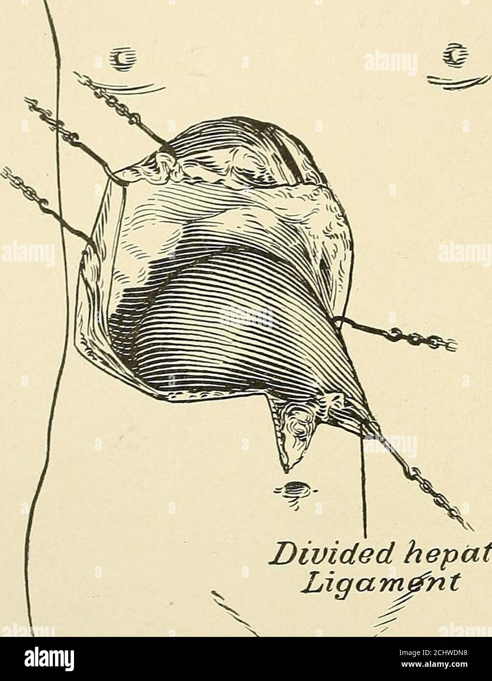 . American practice of surgery ; a complete system of the science and ...