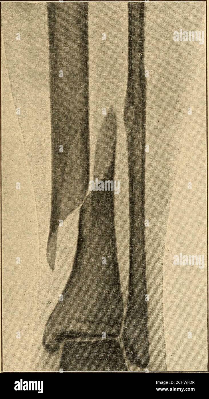 . Atlas and epitome of traumatic . Ycf.JZcr Fig.Sb Lith. Arist E Reich ...