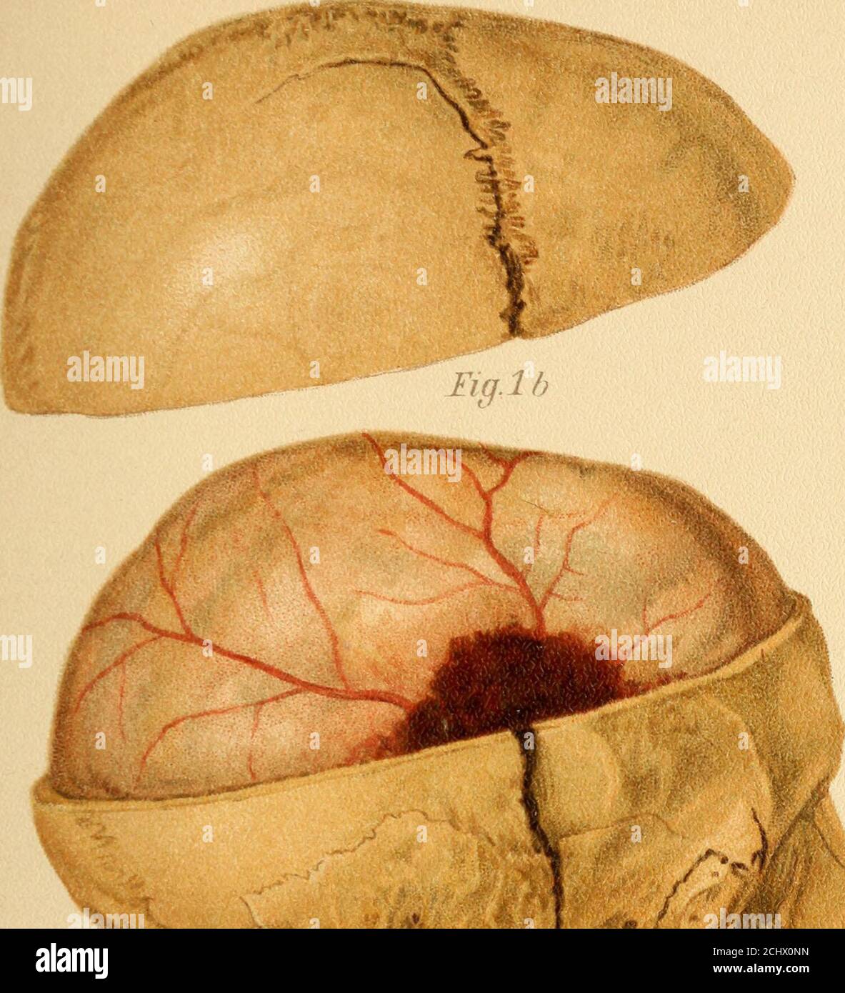 Occipital crest hi-res stock photography and images - Alamy