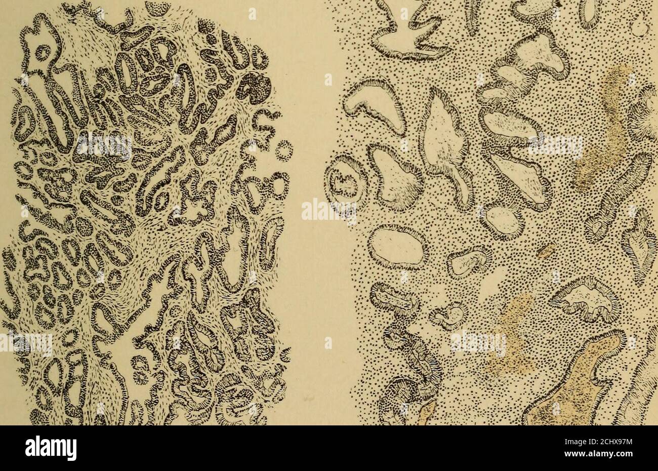 . Atlas and epitome of gynecology . Fig.Z.. FiffJ. M:^+ Fig4r. lith ...
