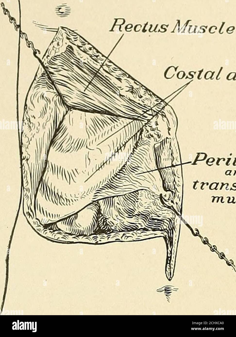 Trap door downward hi-res stock photography and images - Alamy