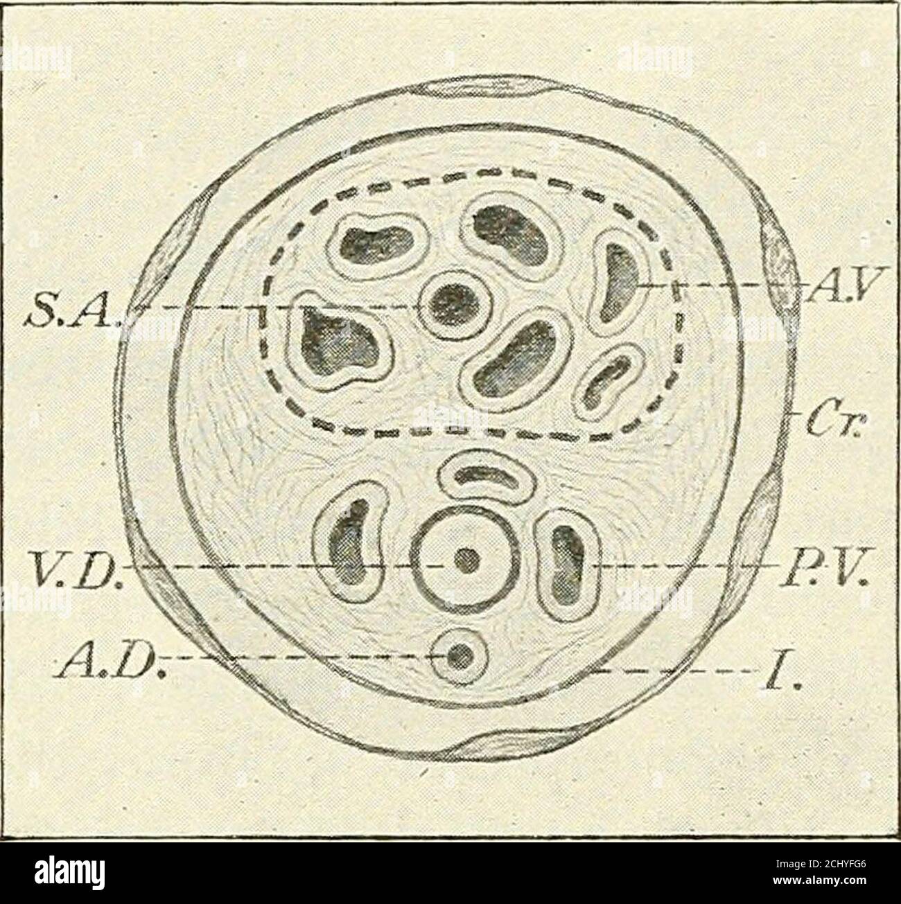 . A manual of operative surgery . gthe superficial layers of the cord ...