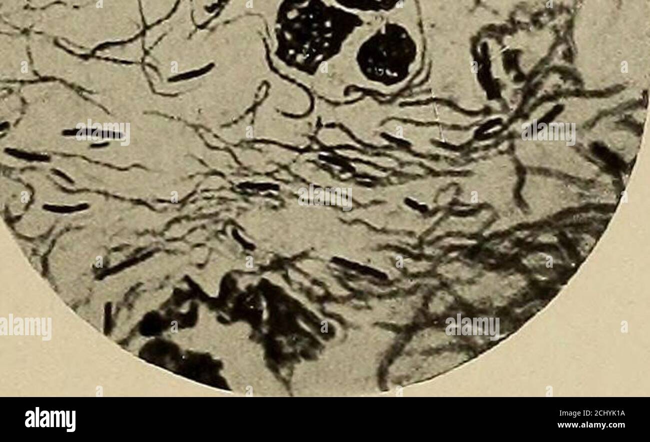 . The Philippine journal of science . Fig. 2.. Chamberlain: Spiroch^t ...