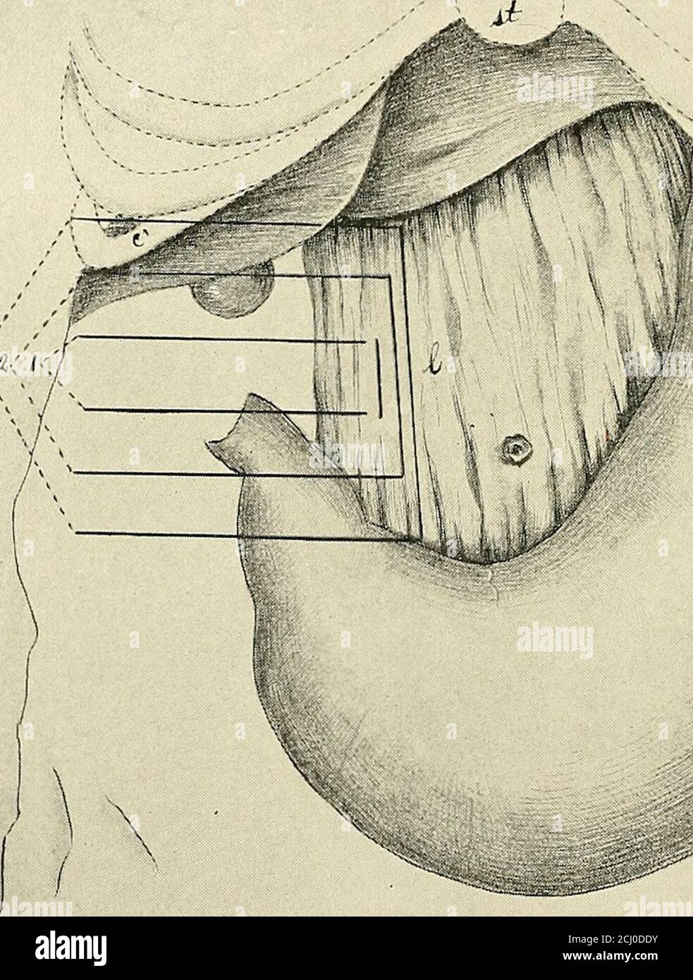 . American practice of surgery ; a complete system of the science and ...