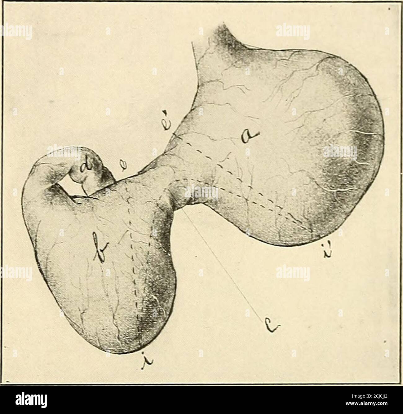 . American practice of surgery ; a complete system of the science and ...