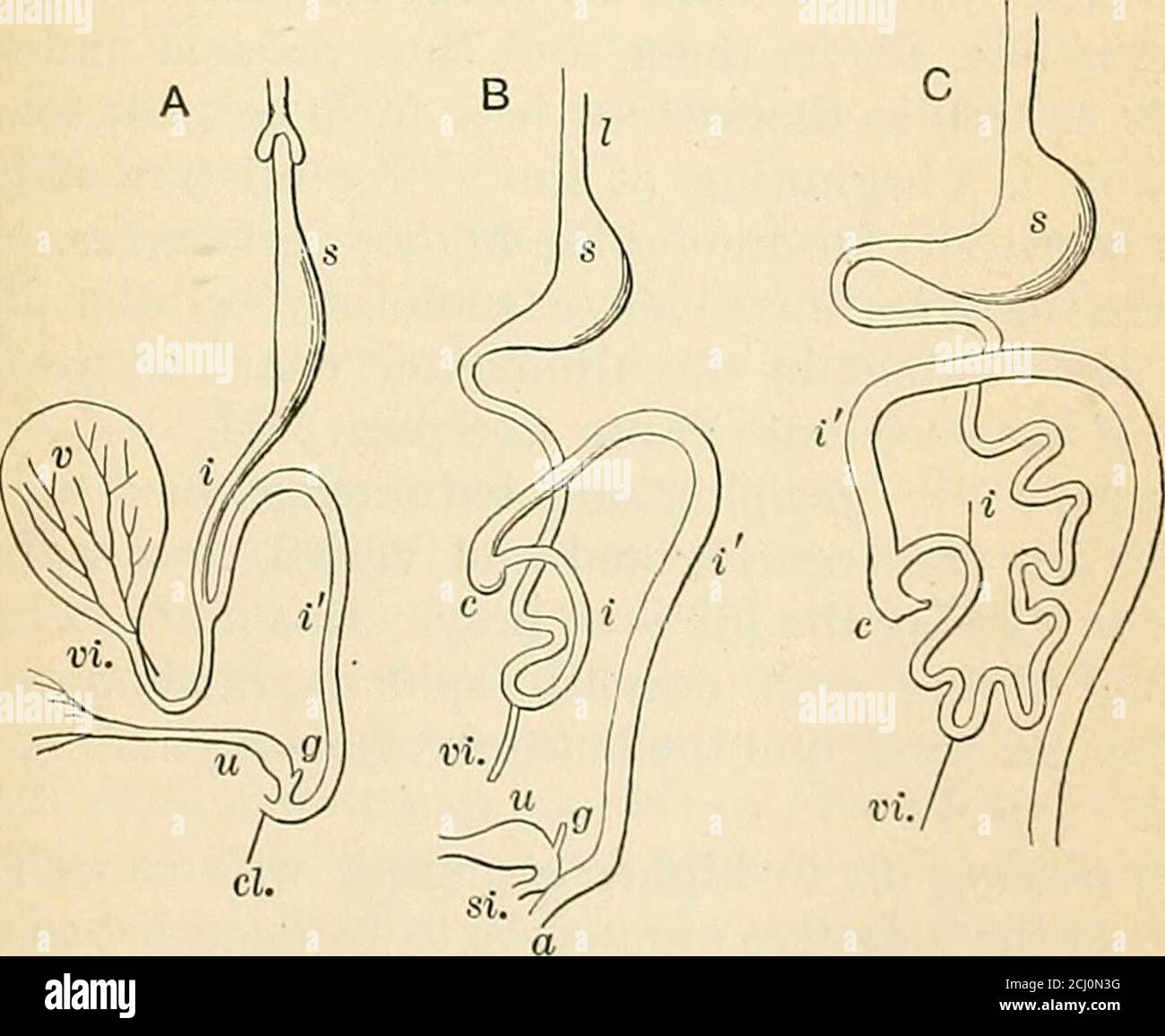 Diverticulum large intestine hi-res stock photography and images - Alamy