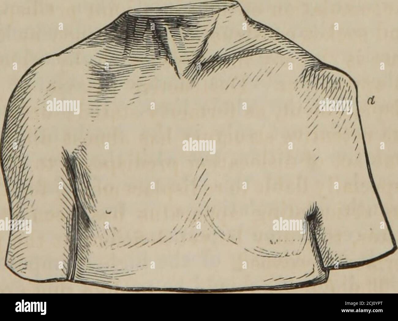 Ruptured limb hi-res stock photography and images - Alamy