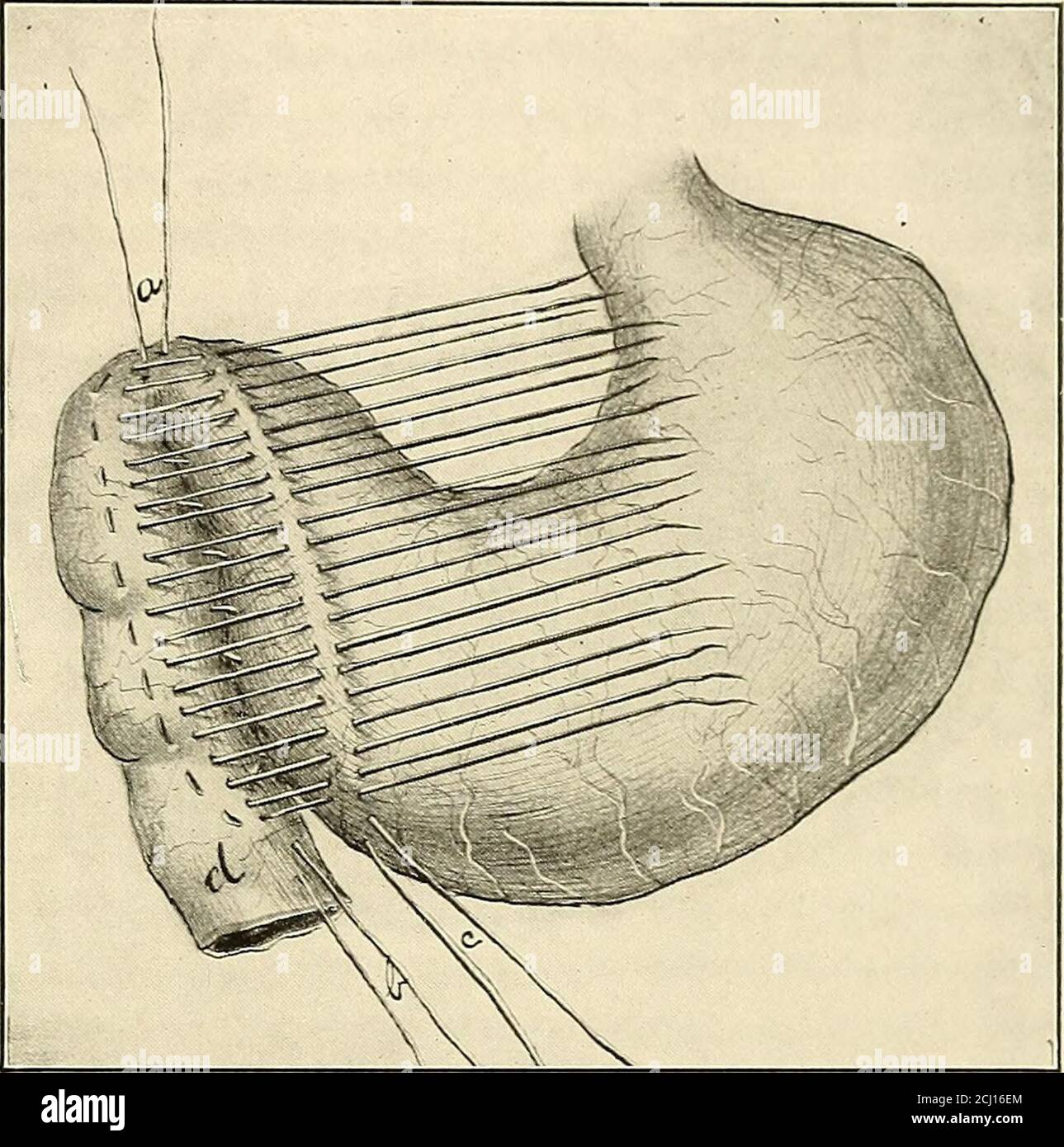 . American practice of surgery ; a complete system of the science and ...