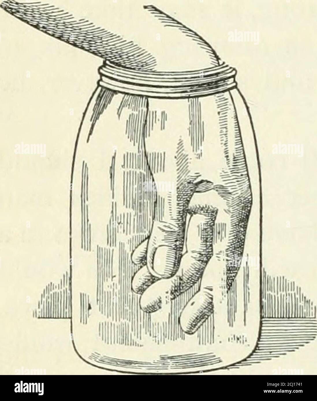 Wrist Cutting Drawings