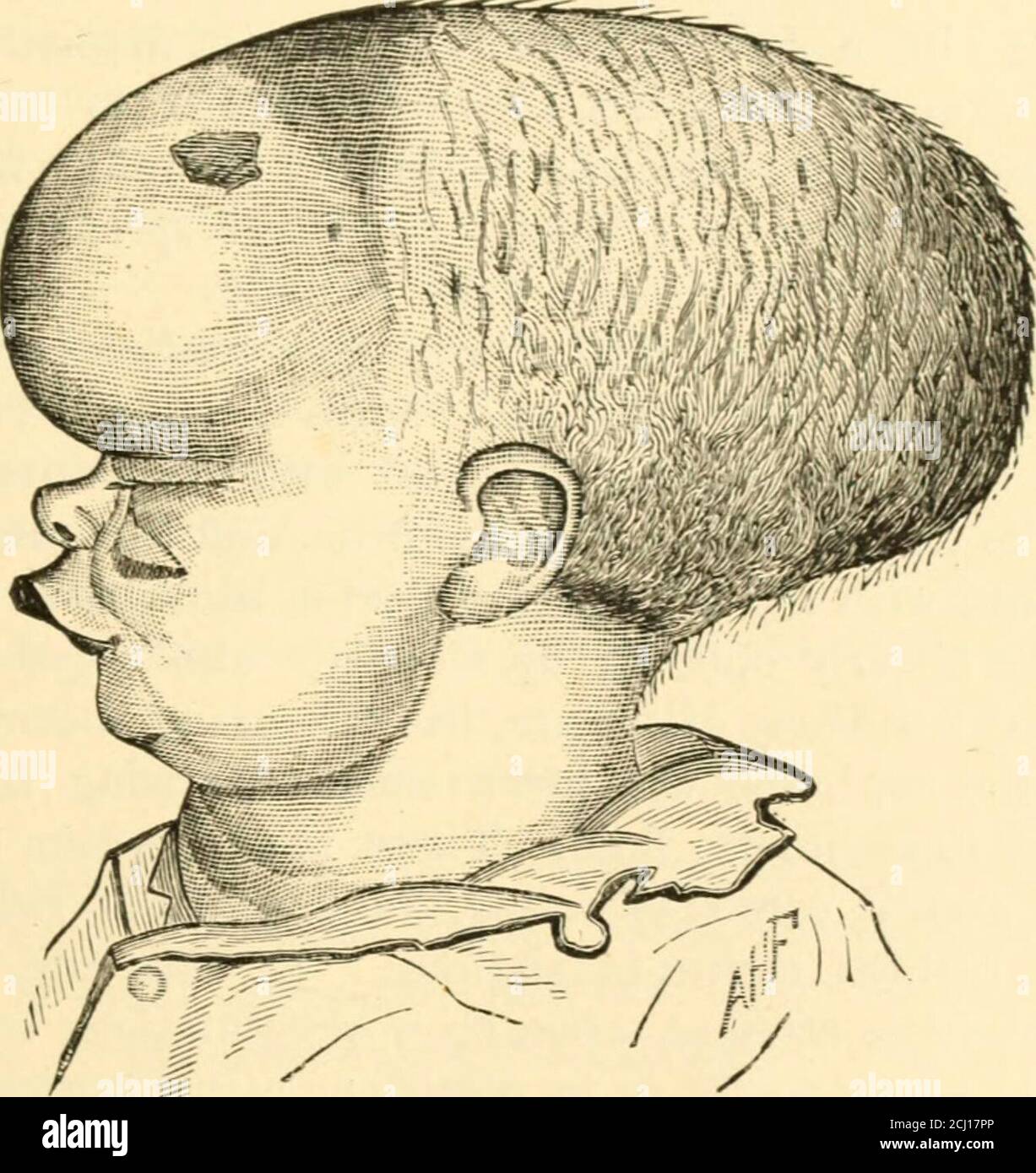 . The science and art of midwifery . In. 115. Outline of head after ...