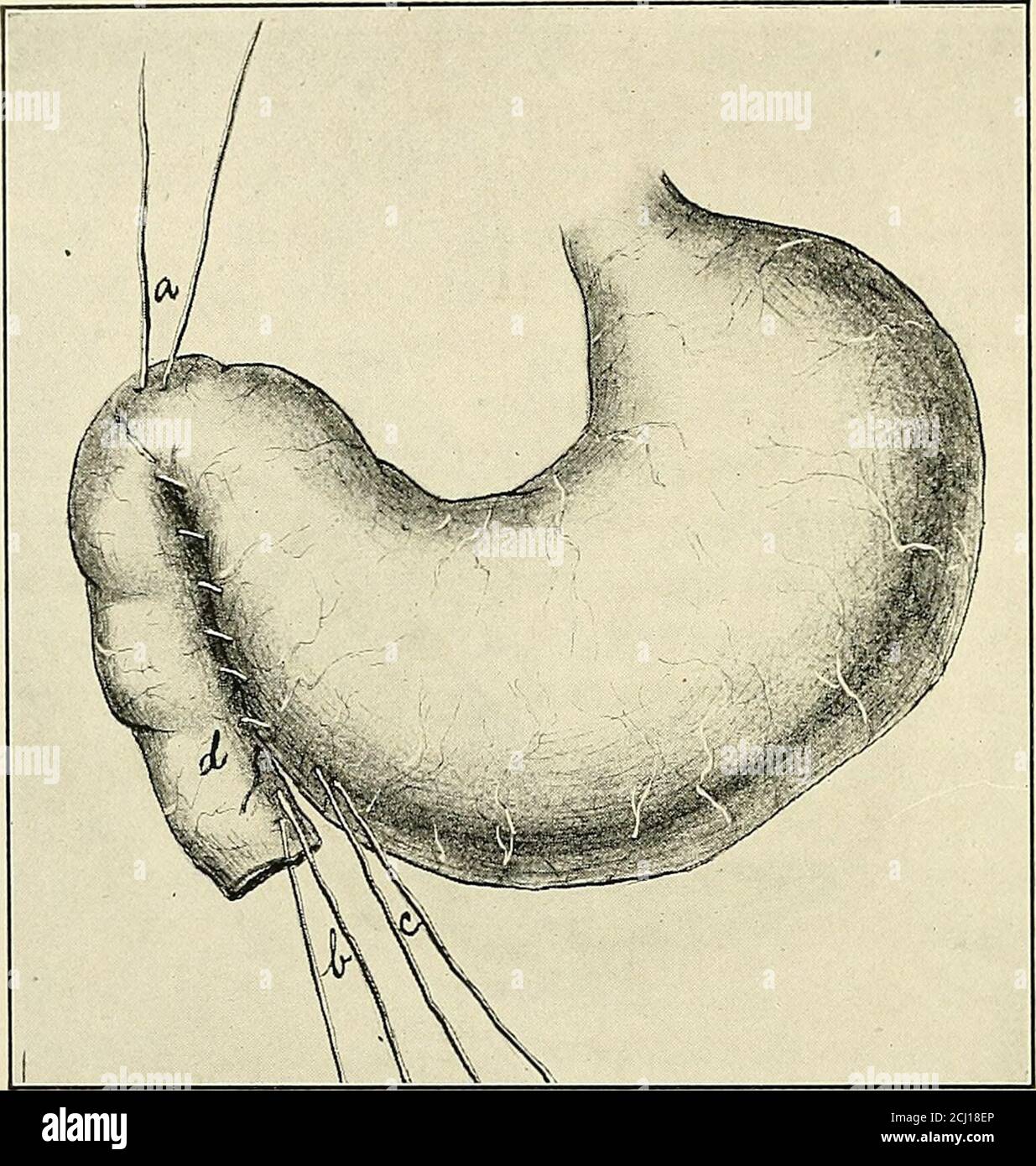 . American practice of surgery ; a complete system of the science and ...