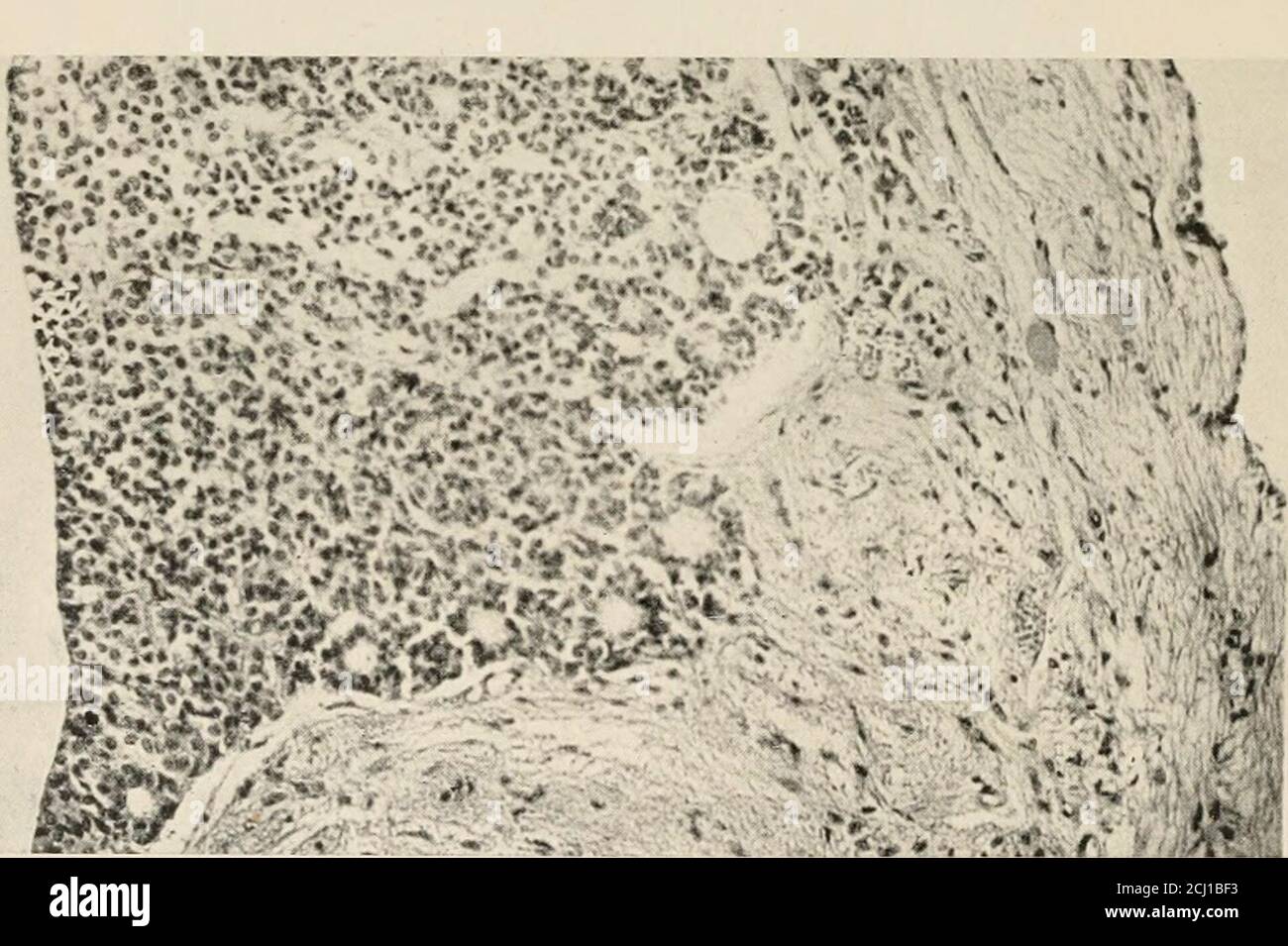 Pars nervosa pituitary hi-res stock photography and images - Alamy