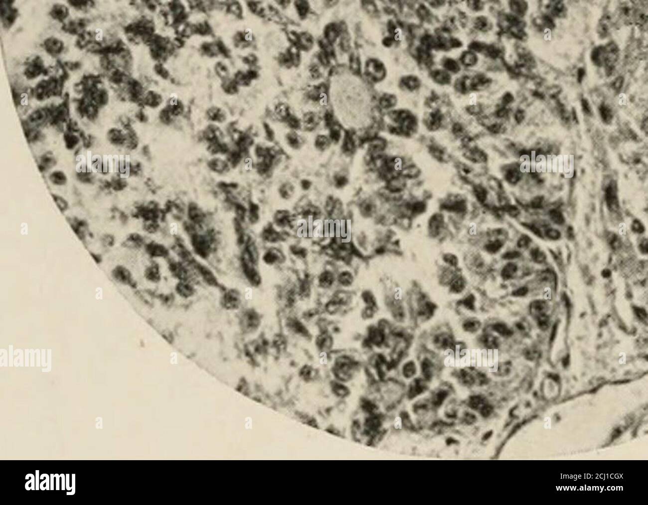 Pituitary pars intermedia hi-res stock photography and images - Alamy