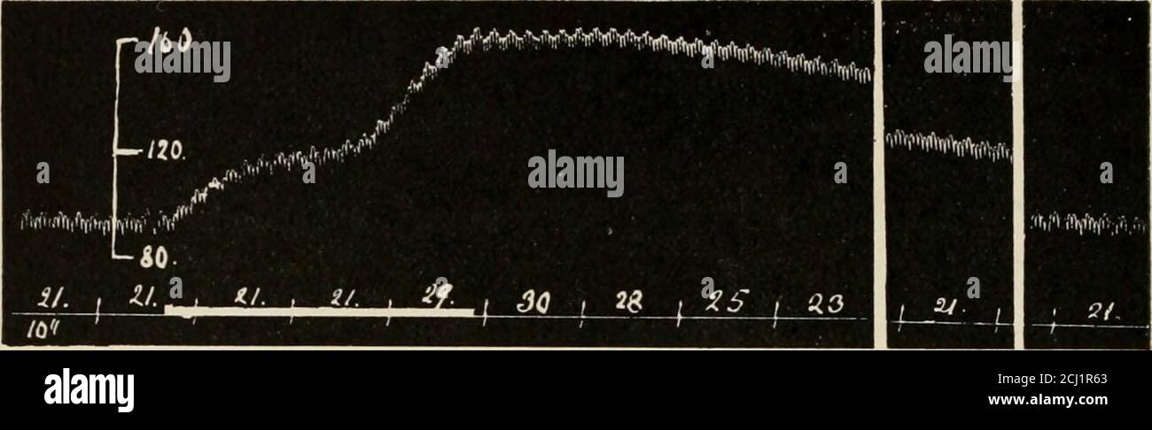 Blood outpouring hi-res stock photography and images - Alamy