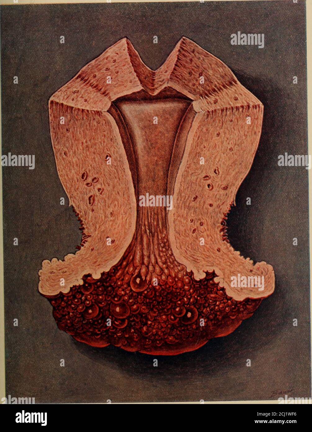 . The diagnosis of diseases of women . this process theuterus becomes ...