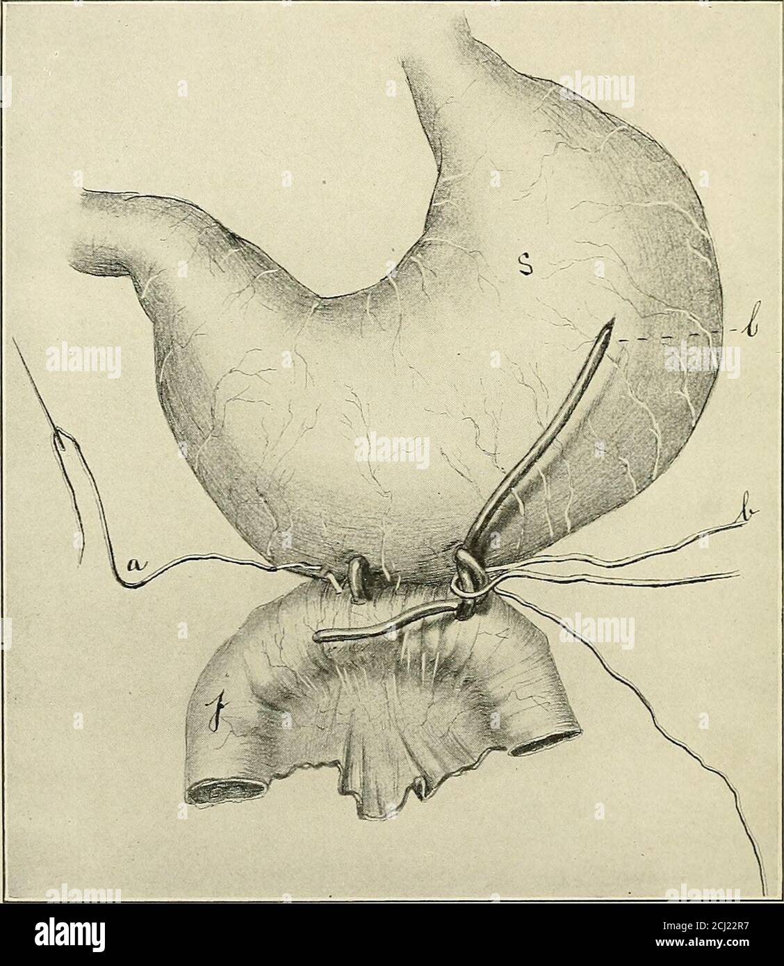 . American practice of surgery ; a complete system of the science and ...