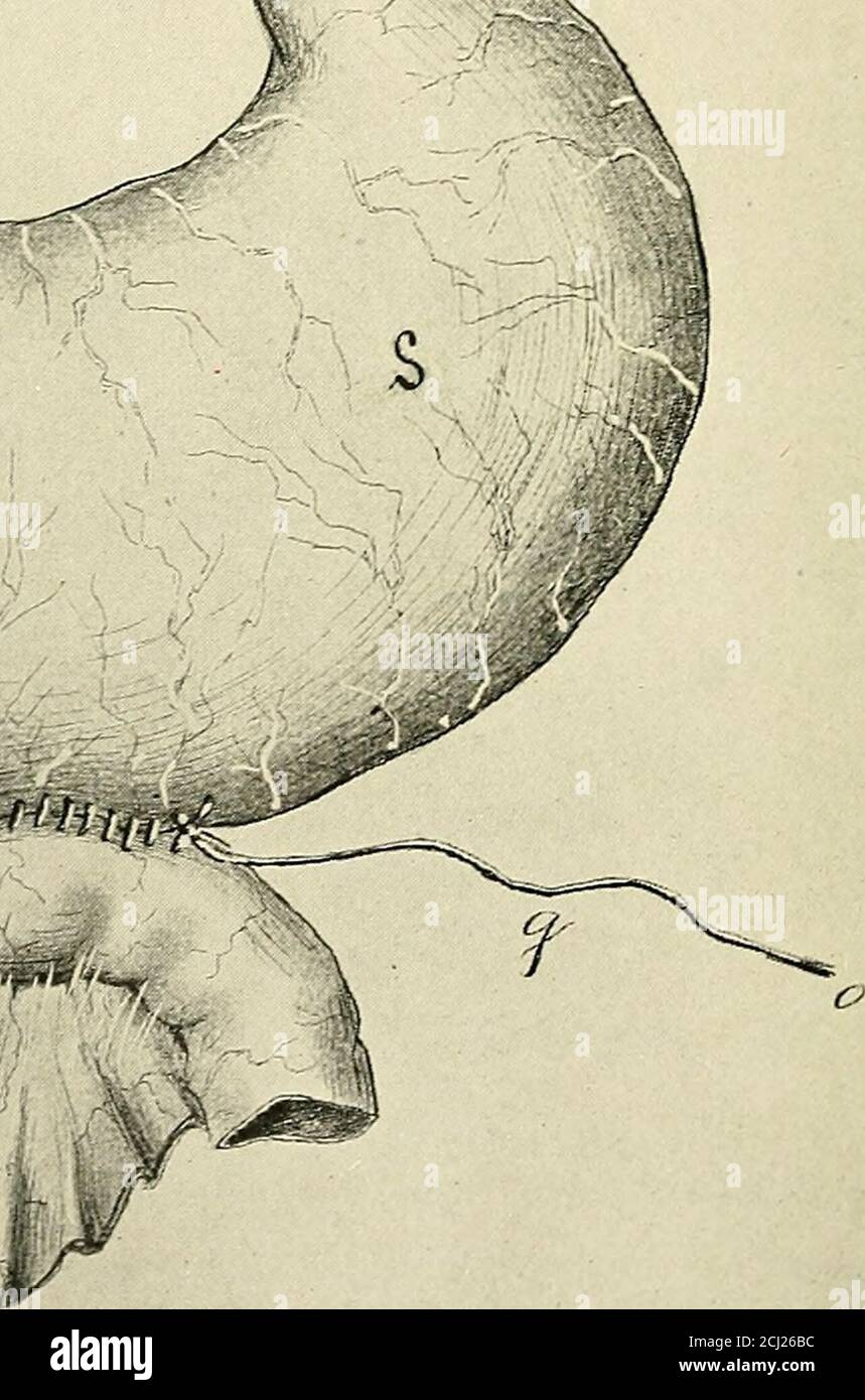 . American practice of surgery ; a complete system of the science and ...