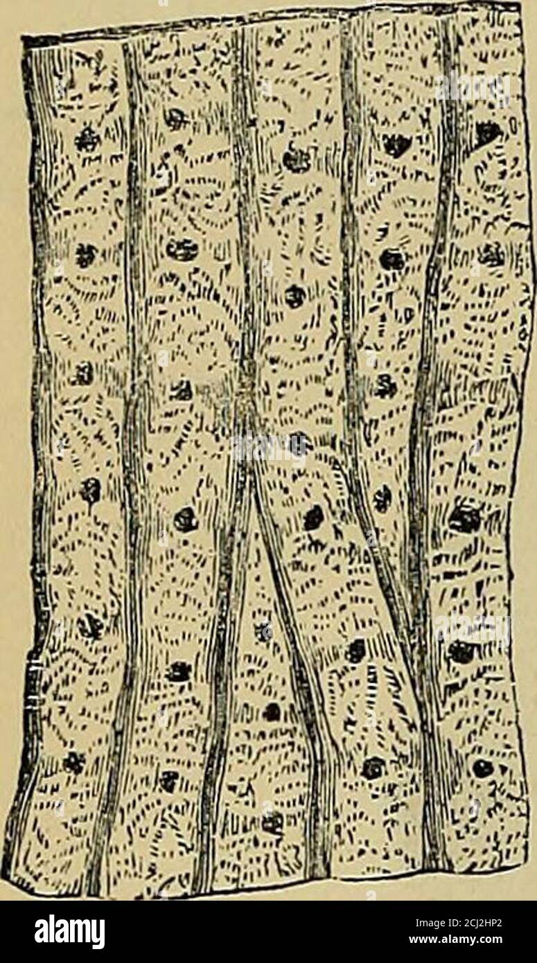 Sweat gland duct hi-res stock photography and images - Alamy